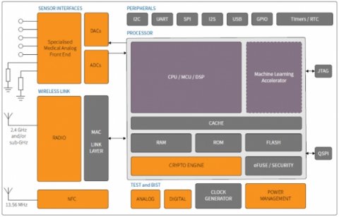 Customisable wireless medical sensor chip with machine learning ...
